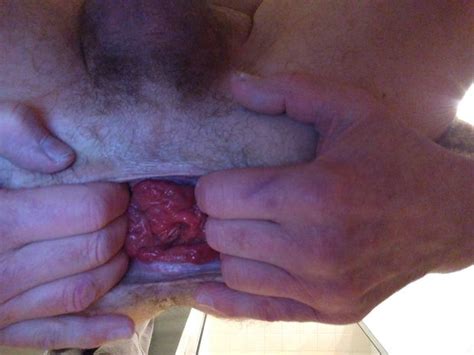 Beginning Of The Rose Bud Rusti