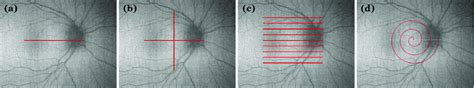 Scan Patterns Used In Microscope Integrated Oct A B Scan Line B