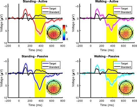 Does The Electrode Amplification Style Matter A Comparison Of Active
