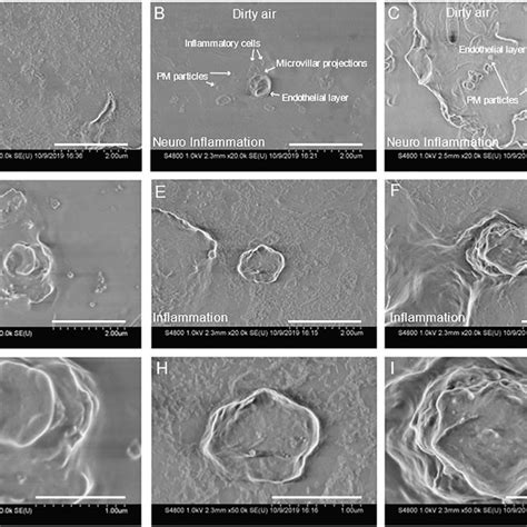 Evaluation Of Topological Features Of Mouse Brain Tissues By Fe Sem