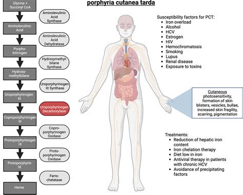 Porphyria Causes Symptoms Diagnosis Prevention Treatment