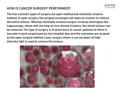 Ppt Surgical Oncology Treatment Procedures And Recovery Powerpoint
