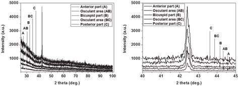 Xrd Patterns Of The Main Regions Of Orthodontic Variable Force 3