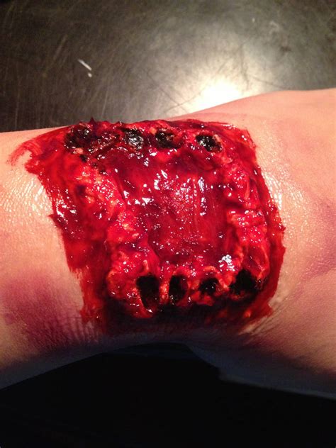 Zombie Bite Wound By Angel Of The Undead On Deviantart