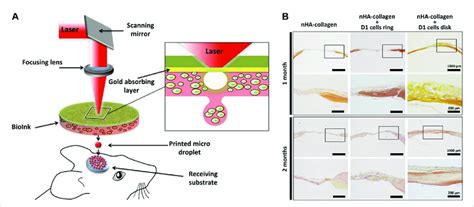 A Schematic Of Bone Repair With The Laser Assisted Bioprinting