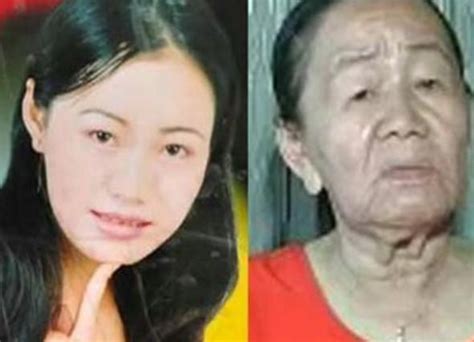 女子晚上和老公睡了一覺，一夜之間變成七旬老太，原因令人心疼 每日頭條