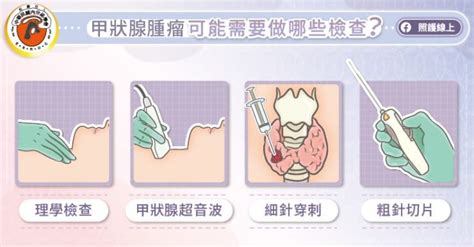 馮提莫自曝罹甲狀腺癌晚期！醫：聲音沙啞、吞嚥不適5症狀別輕忽 健康遠見