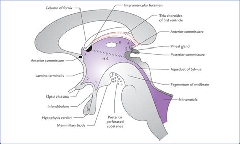 Diencephalon And Third Ventricle Neupsy Key