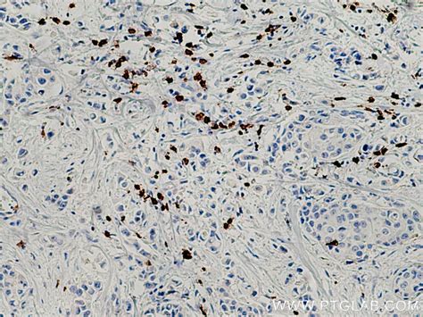 Cd8a Antibody 66868 1 Ig Proteintech