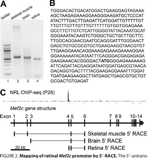 Figure 2 From The Transcription Factor Neural Retina Leucine Zipper Nrl Controls Photoreceptor