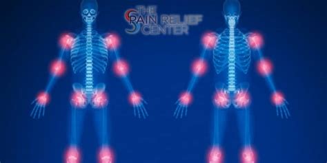 Joint Injections In Frisco And Plano Tx The Pain Relief Center