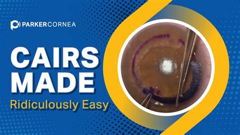 Cairs Made Ridiculously Easy Youtube