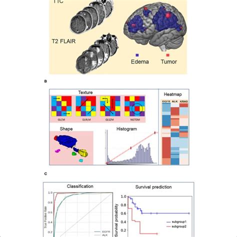 Schema For Brain Tumor Segmentation Radiomic Feature Extraction And Download Scientific