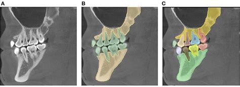 Differences Between Semantic And Instance Segmentation