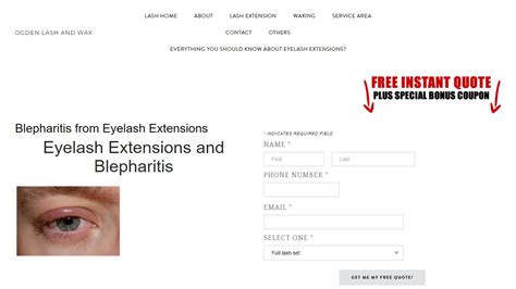 Managing Blepharitis With Eyelash Extensions Beauty Tips