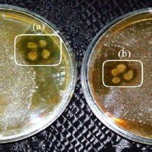 Anti Listeria Activity Of Bacteriocins From L Pantarum A And P