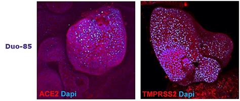Gastrointestinal Organoid Biobank