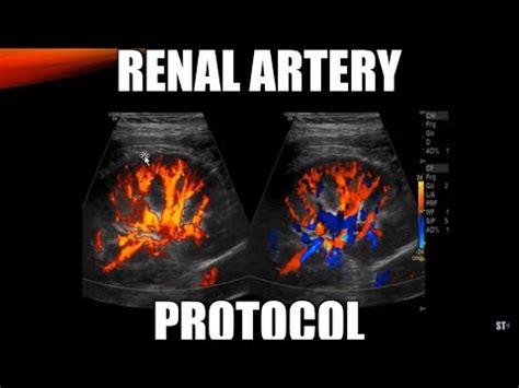Renal Sonogram Cpt Codes The Ultimate 2024 Cheat Sheet Answernow Blog