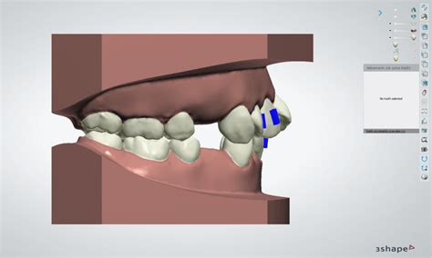 How We Make Clear Aligner Works China Orthodontic