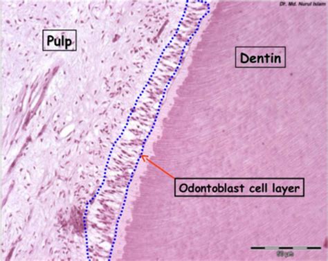 Hl9 Dentine Pulp Complex And Dentine Sensitivity Flashcards Quizlet