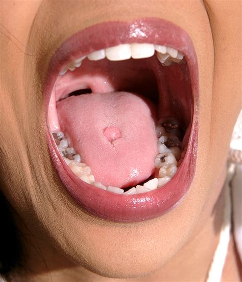 Forumophilia Porn Forum Bdsm Domination Bondage Fetish All Sex Anal Sex Page 89