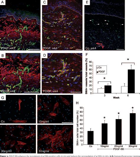 Figure 1 From Tumorigenesis And Neoplastic Progression Platelet Derived Growth Factor Bb
