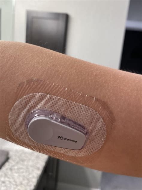 Tegaderm Bandage Day 9 And Still Going Strong Keeps The Dexcom Adhesive Reaction Away Love