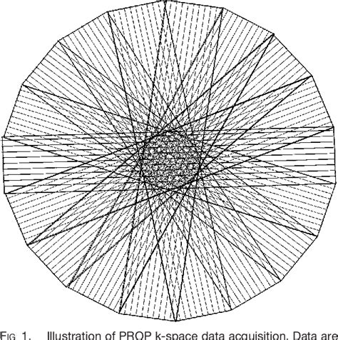 [pdf] Spin Echo Sequences Reconstruction And Single Shot Fast Overlapping Parallel Lines With