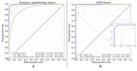 Macro Average Roc Curves Showing A Comparison Between Lightoct Model Download Scientific