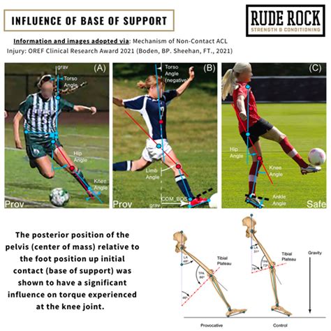 Acl Rehabilitation From An Sandc Point Of View Sportsmith