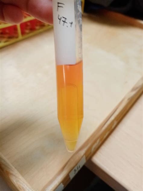 588 Questions With Answers In Bacteriology Science Topic