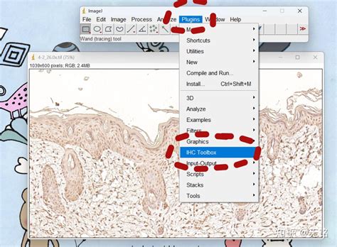 如何使用 Imagej 软件分析组织切片免疫组化面积？ 知乎