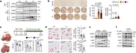 promotion of hepatocarcinogenesis by ddr1 a western blot of ddr1 in