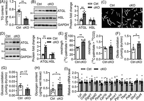 Cardiac‐specific Deletion Of Bscl2 Induces Cardiac Triglyceride