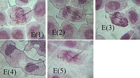 Photomicrographs Showing The Effect Of Methanol Extract Of M Oleifera