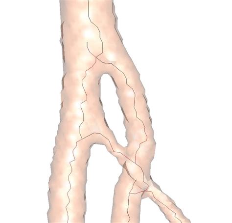 Examples Of Loop Correction A Global Rendering View B Download Scientific Diagram