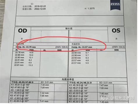 拉远镜选哪品牌有效入坑必读 知乎
