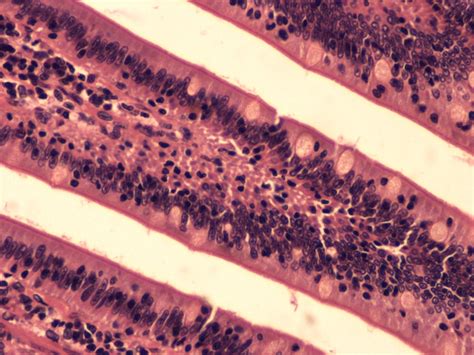 Jejunum Slide 40x Diagram Quizlet