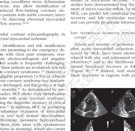 Example Of A Patient With Acute Anterior Myocardial Infarction On Download Scientific Diagram