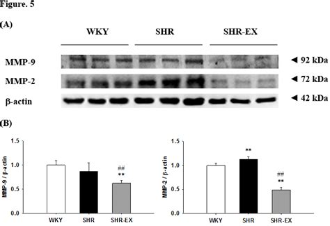 A The Representative Protein Products Of Matrix Metalloproteinase 9 Download Scientific