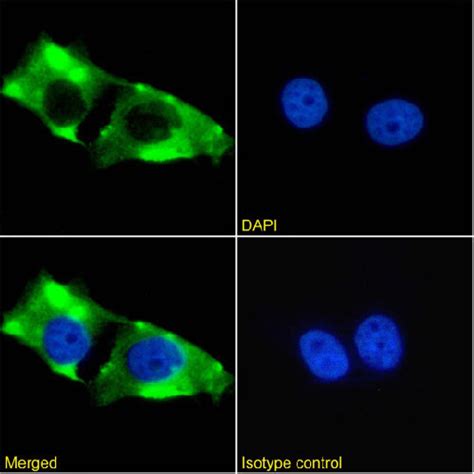 Erbb2 Her 2 Recombinant Monoclonal Antibody Saic 02a 7 Ma5 47890