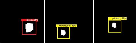 Detection And Classification Result Showing Glioma Meningioma And