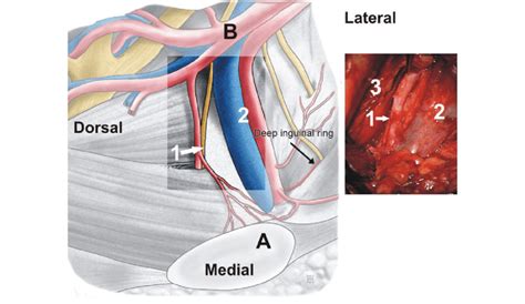 Sagittal Section Of The Pelvis On The Left And Corresponding