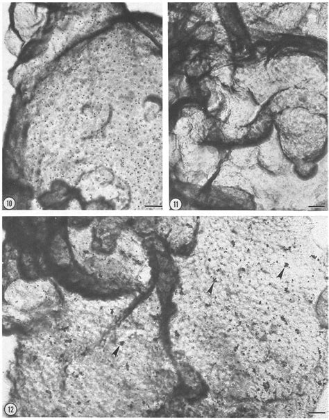 Fig 10 Surface Replica Of A Washed Platelet Stimulated With Ade Download Scientific Diagram