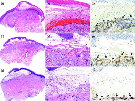 Routine Histopathology Steps Innovative Medi Tech