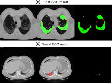 Figure 1 From Medpseg Hierarchical Polymorphic Multitask Learning For