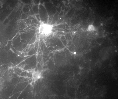 Biologically Plausible Topology Improved Spiking Actor Network For Efficient Deep Reinforcement