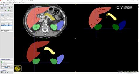 itksnap使用学习 itksnap crosshair csdn博客