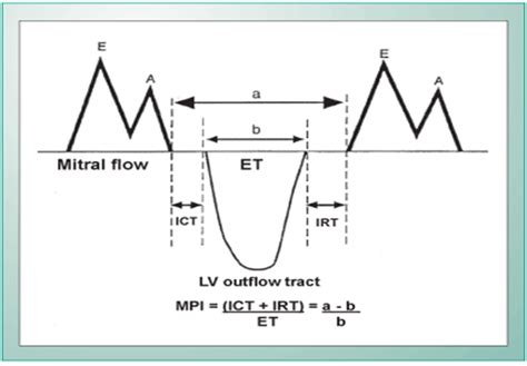Myocardial Performance Index As A Predictor Of IN Hospital And Short Term Outcome After First