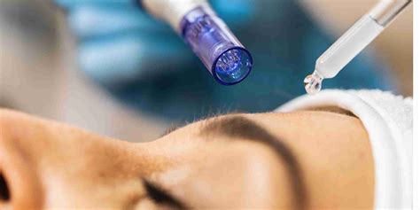 Microneedling With Exosomes For Skin Rejuvenation Vs Prp Gal Pal